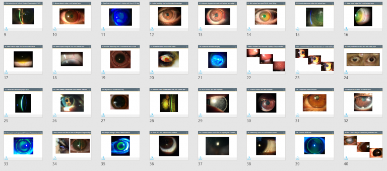 IACLE Image Library – IACLE