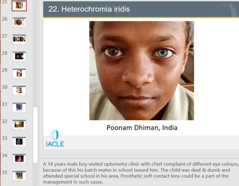 IACLE Image Library – IACLE